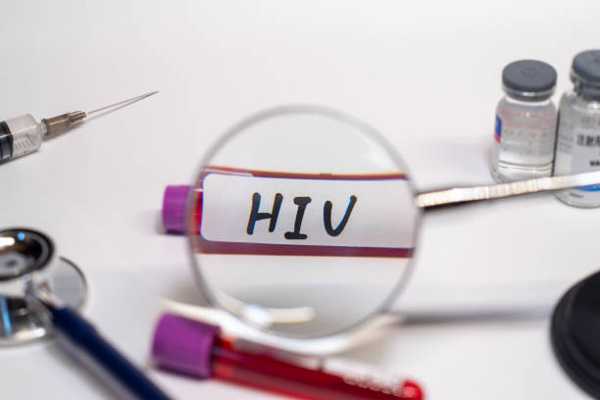 flexfeedspeck.com - Understanding HIV Testing: Types, Process, And ...