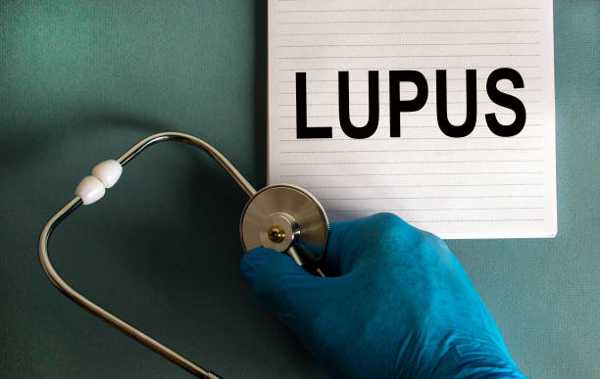 flexfeedspeck.com - Understanding Lupus: Causes, Symptoms, and ...