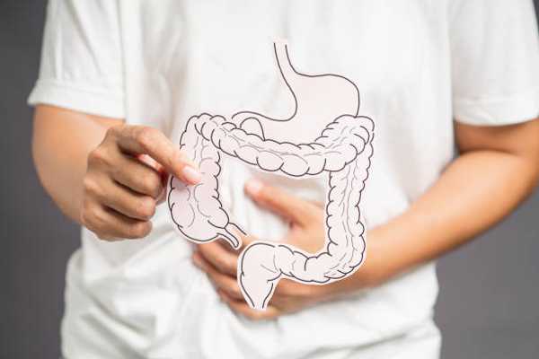 Understanding And Managing Ulcerative Colitis A